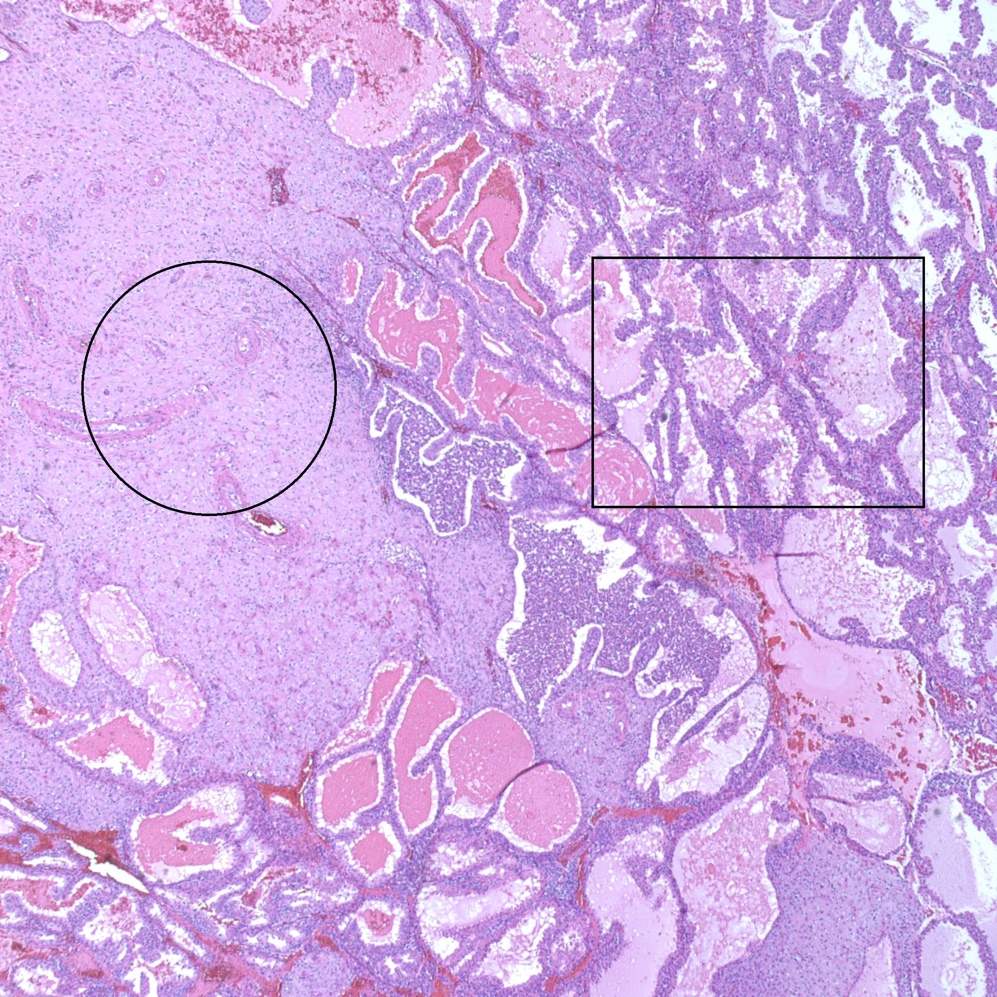Endometrium Quiz | HistoCloud