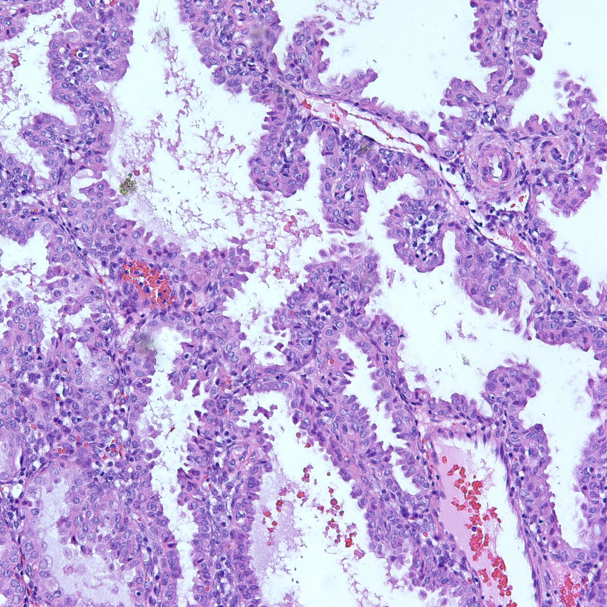 Endometrium Quiz | HistoCloud