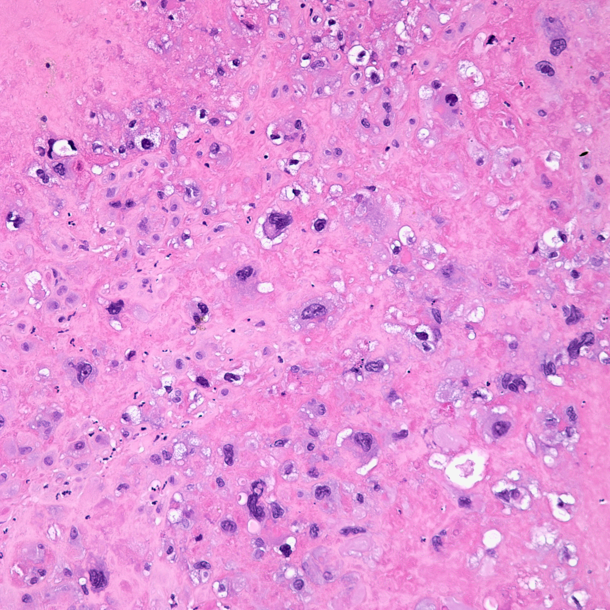 Endometrium Quiz | HistoCloud