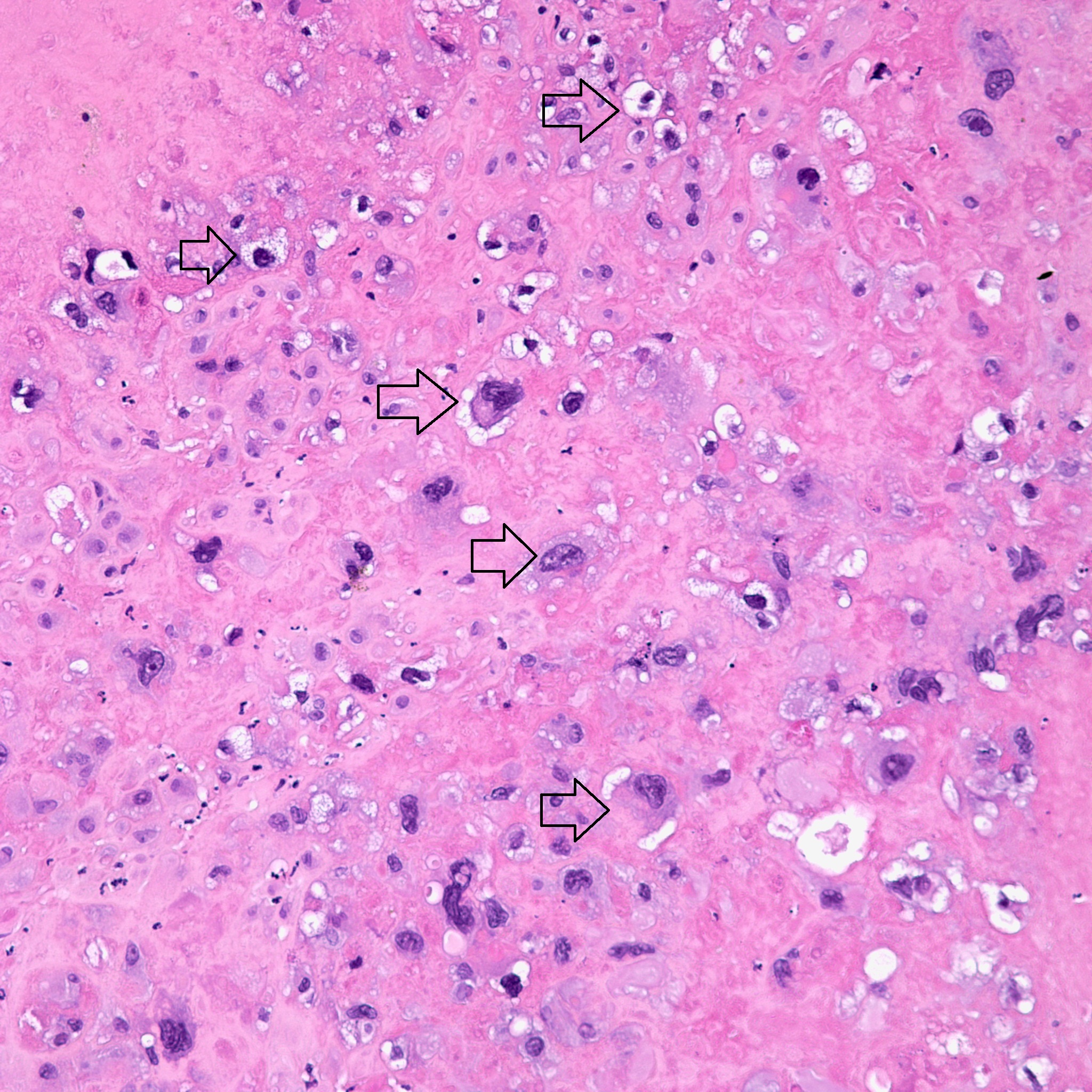 Endometrium Quiz | HistoCloud
